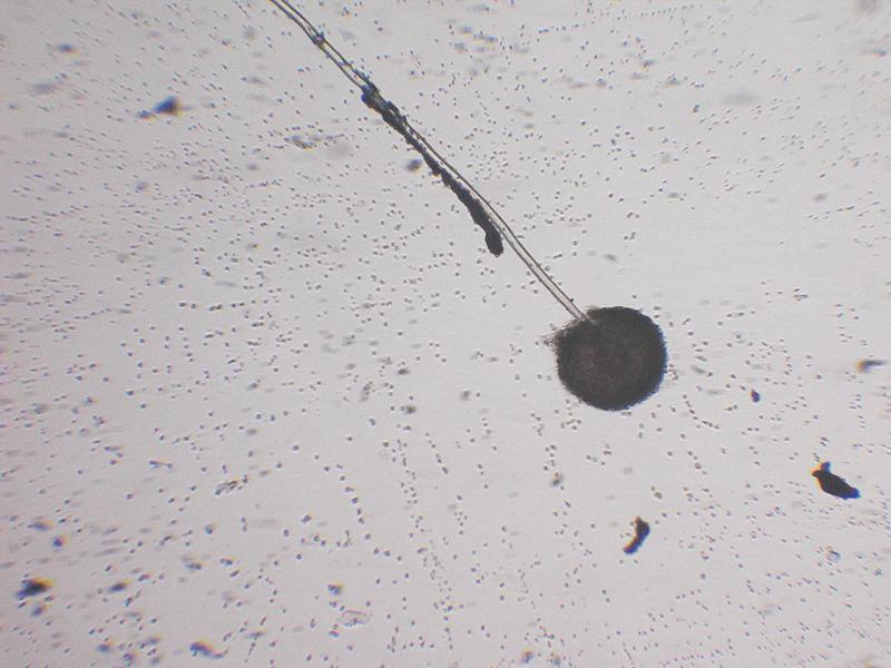 bread mold under microscope at 56x [800*600] | Scrolller