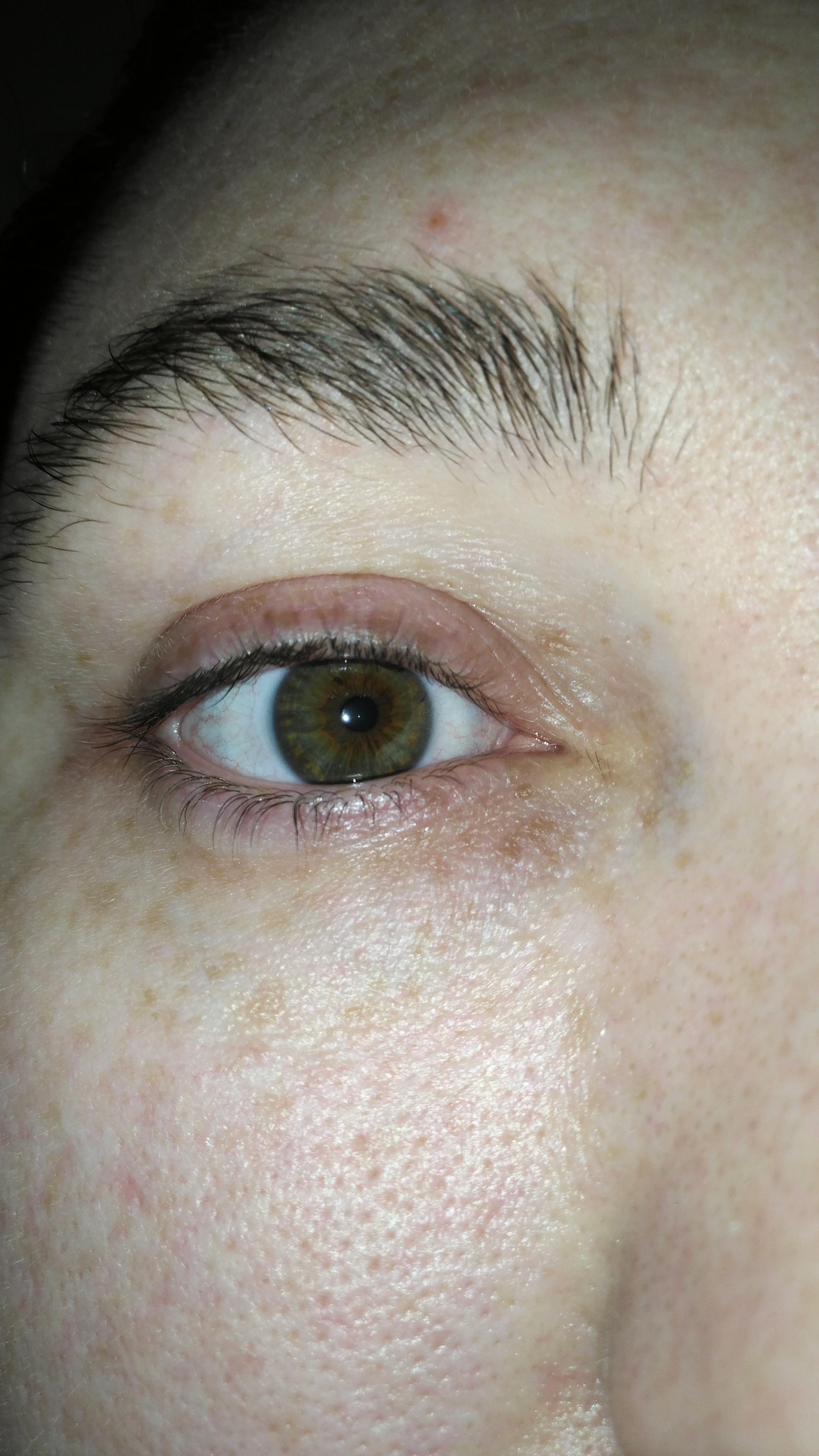 Central heterochromia? | Scrolller