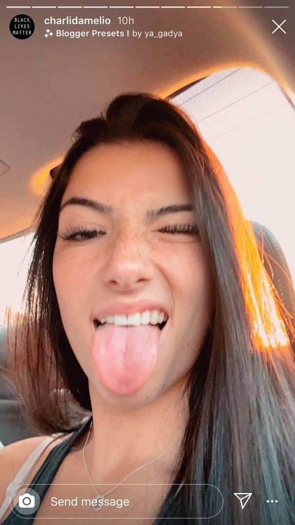 Charli Damelio | Scrolller