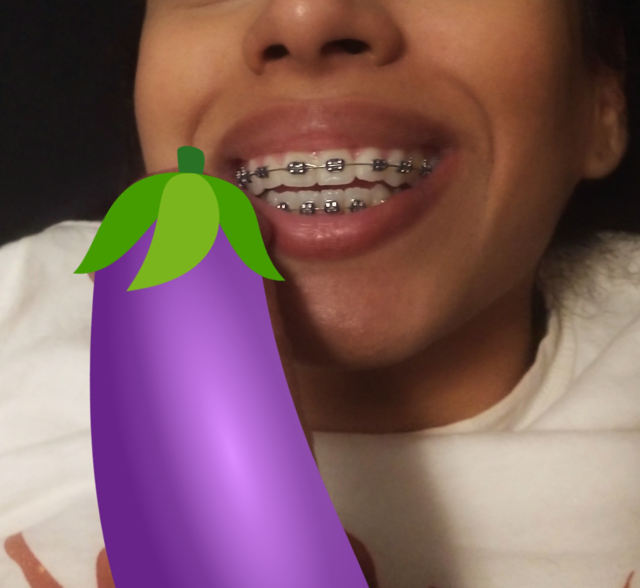 Check out my braces before they get all messy. 💦😁 | Scrolller