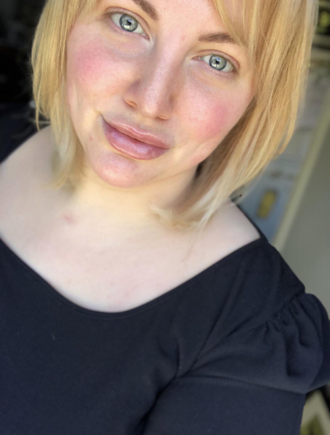 Cold weather gives me rosey cheeks! | Scrolller