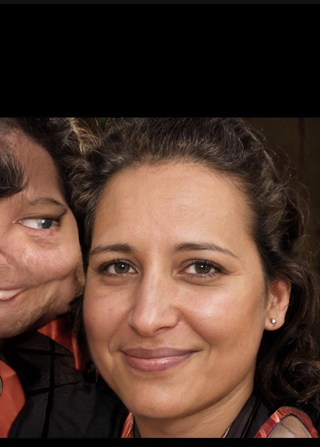 Conjoined head twins? | Scrolller