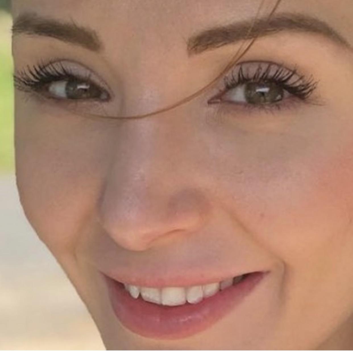 Crooked teeth, ouch! | Scrolller