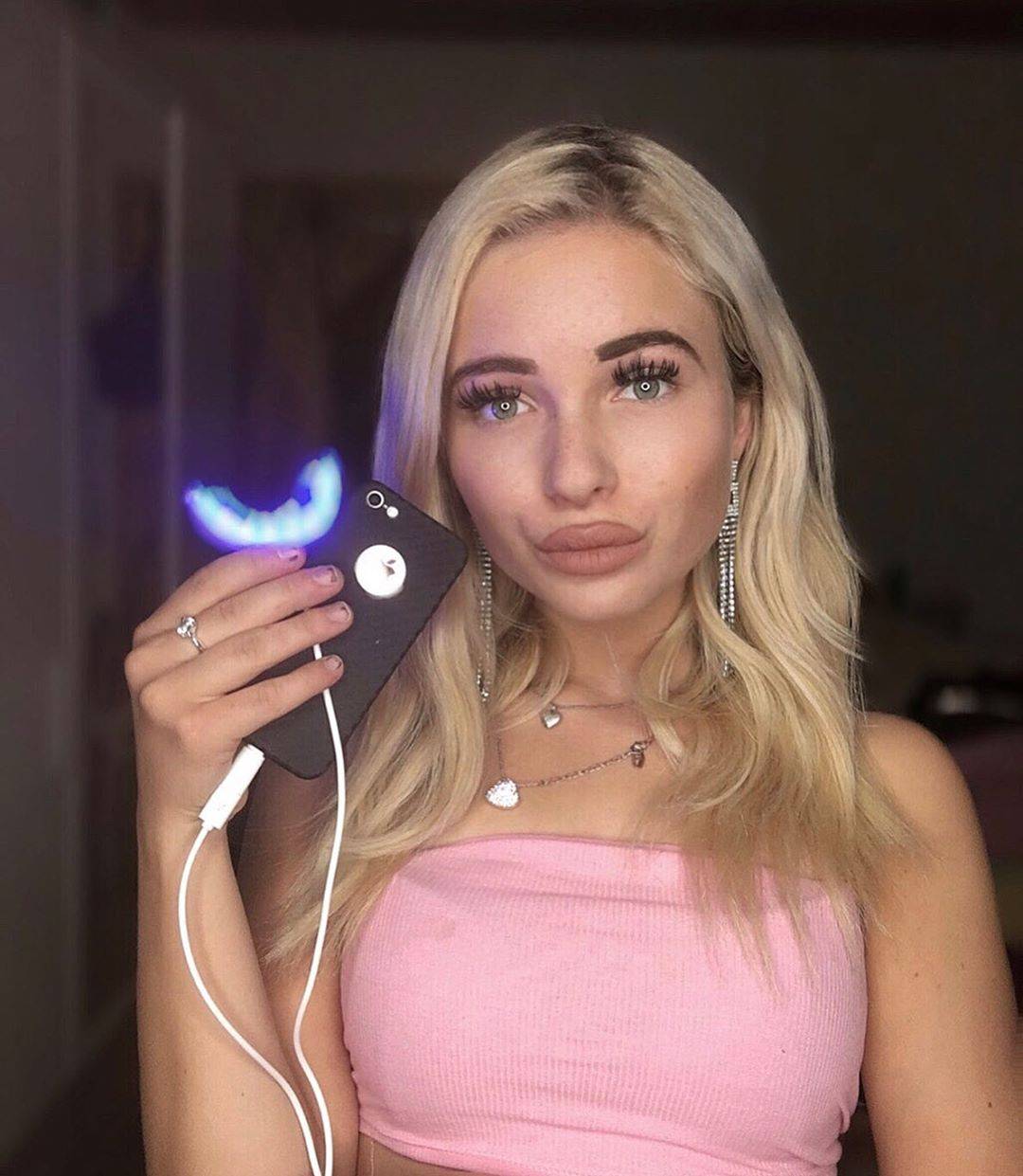 Denkt ihr celinas lippen sind real? | Scrolller