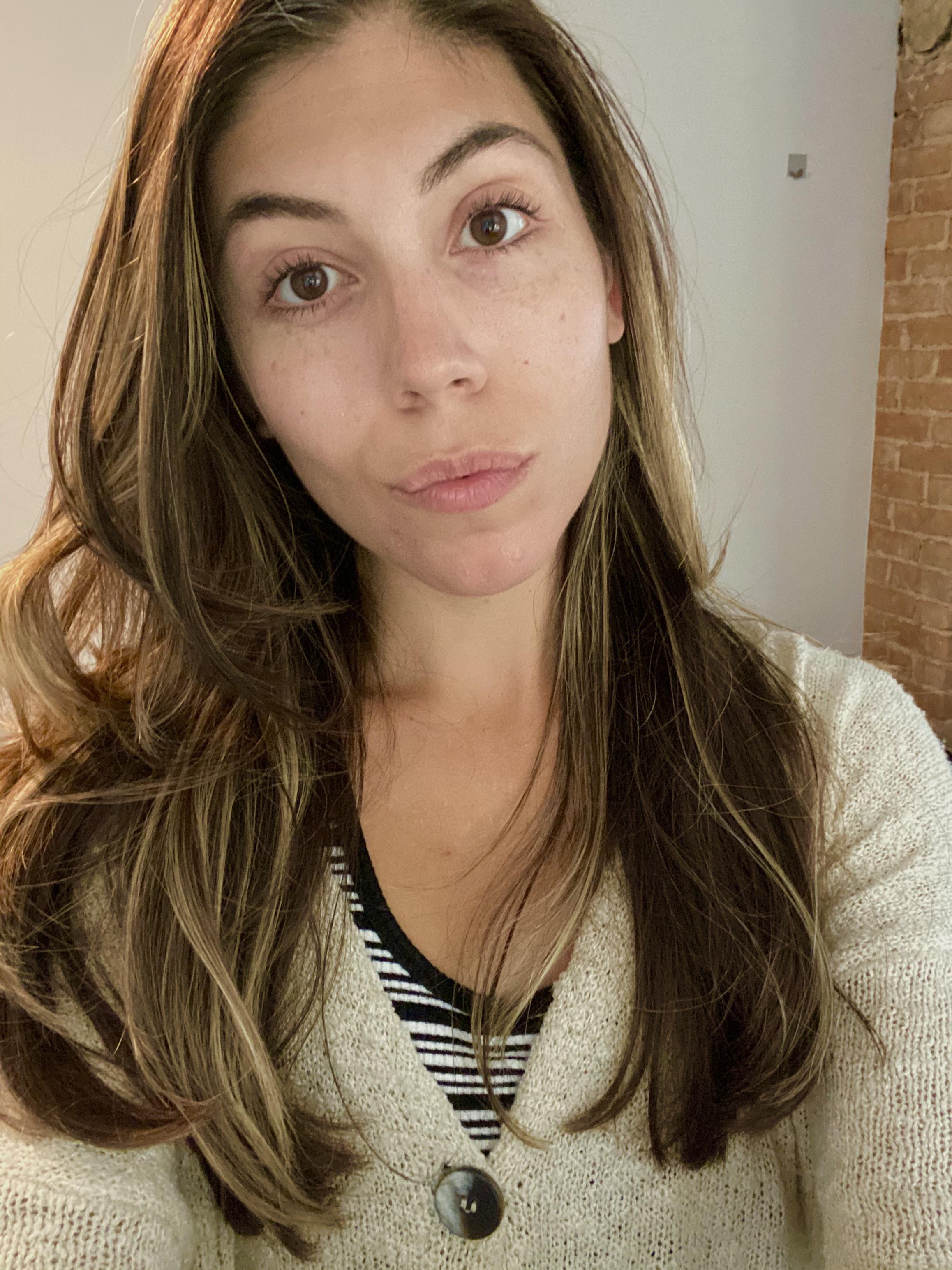 Do the freckles around my eyes count? 🥺 | Scrolller