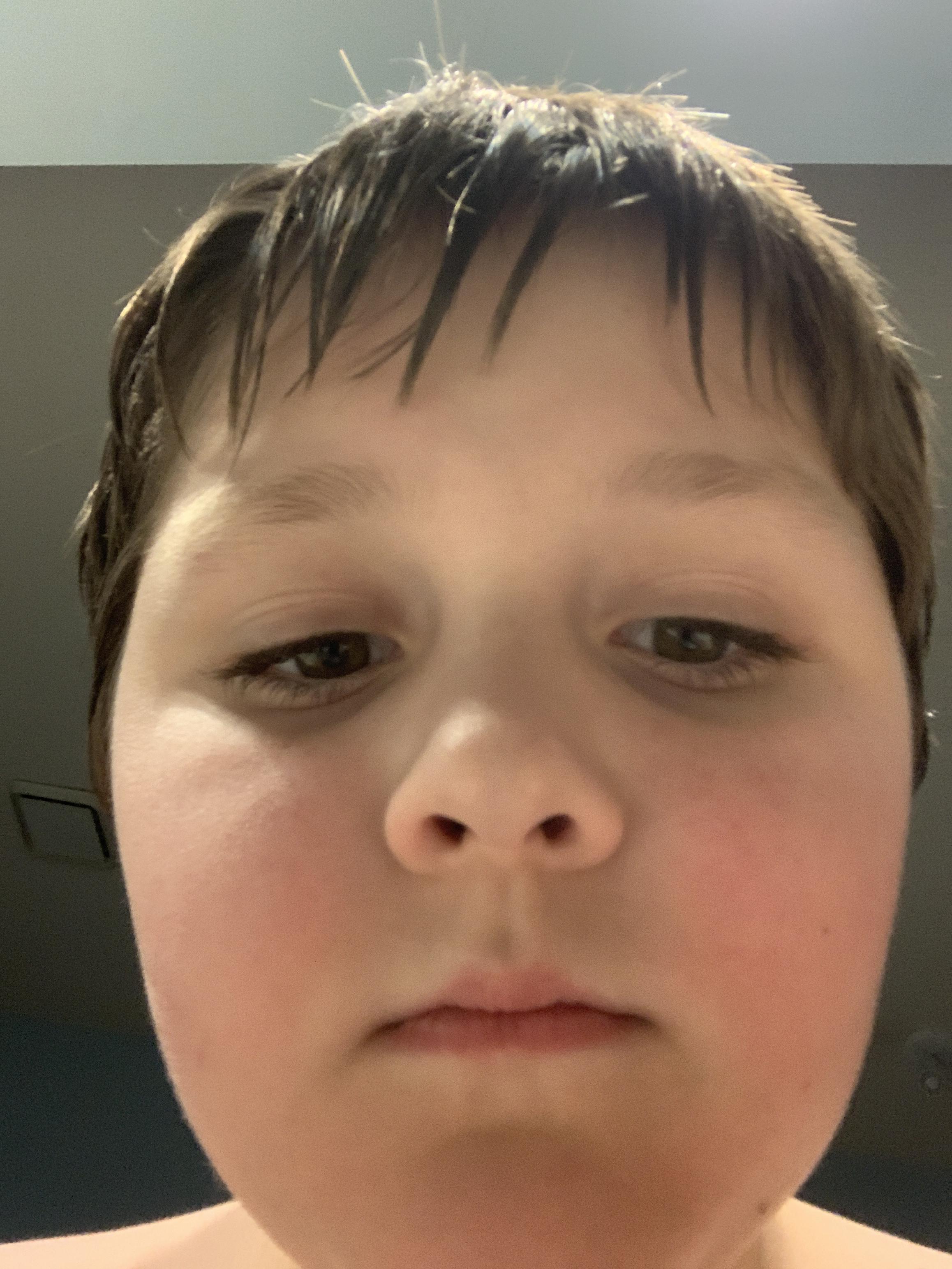 Does my face look normal? | Scrolller