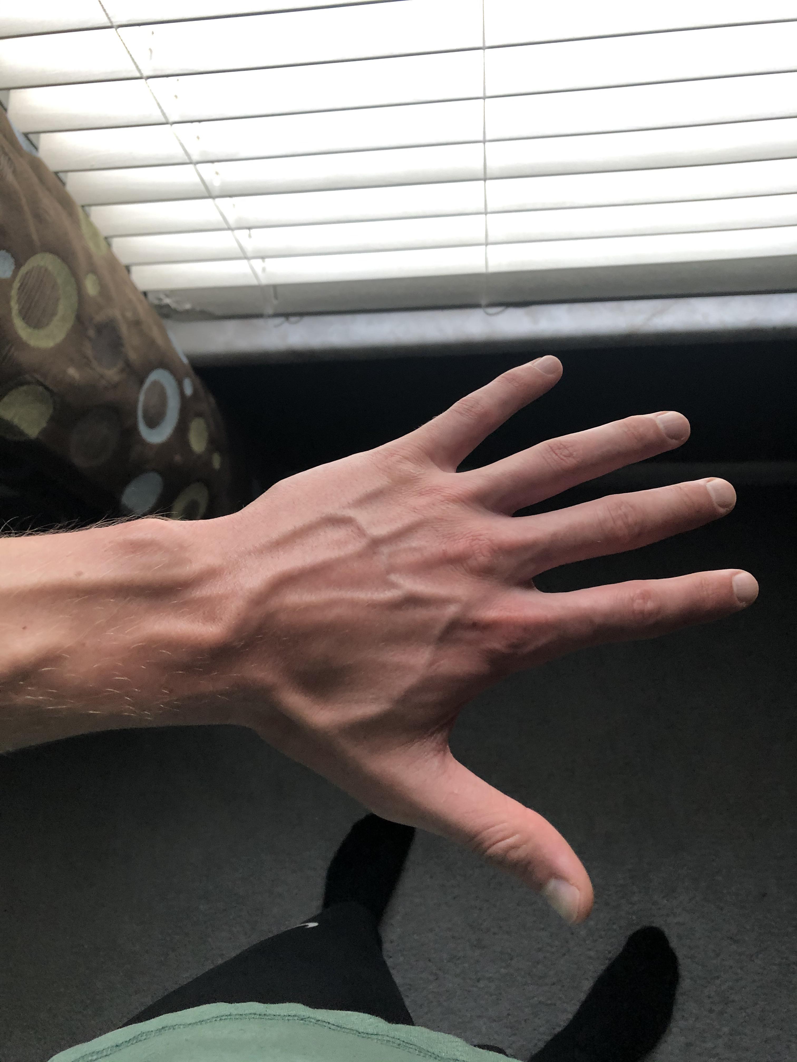 Does my hand look weird? | Scrolller