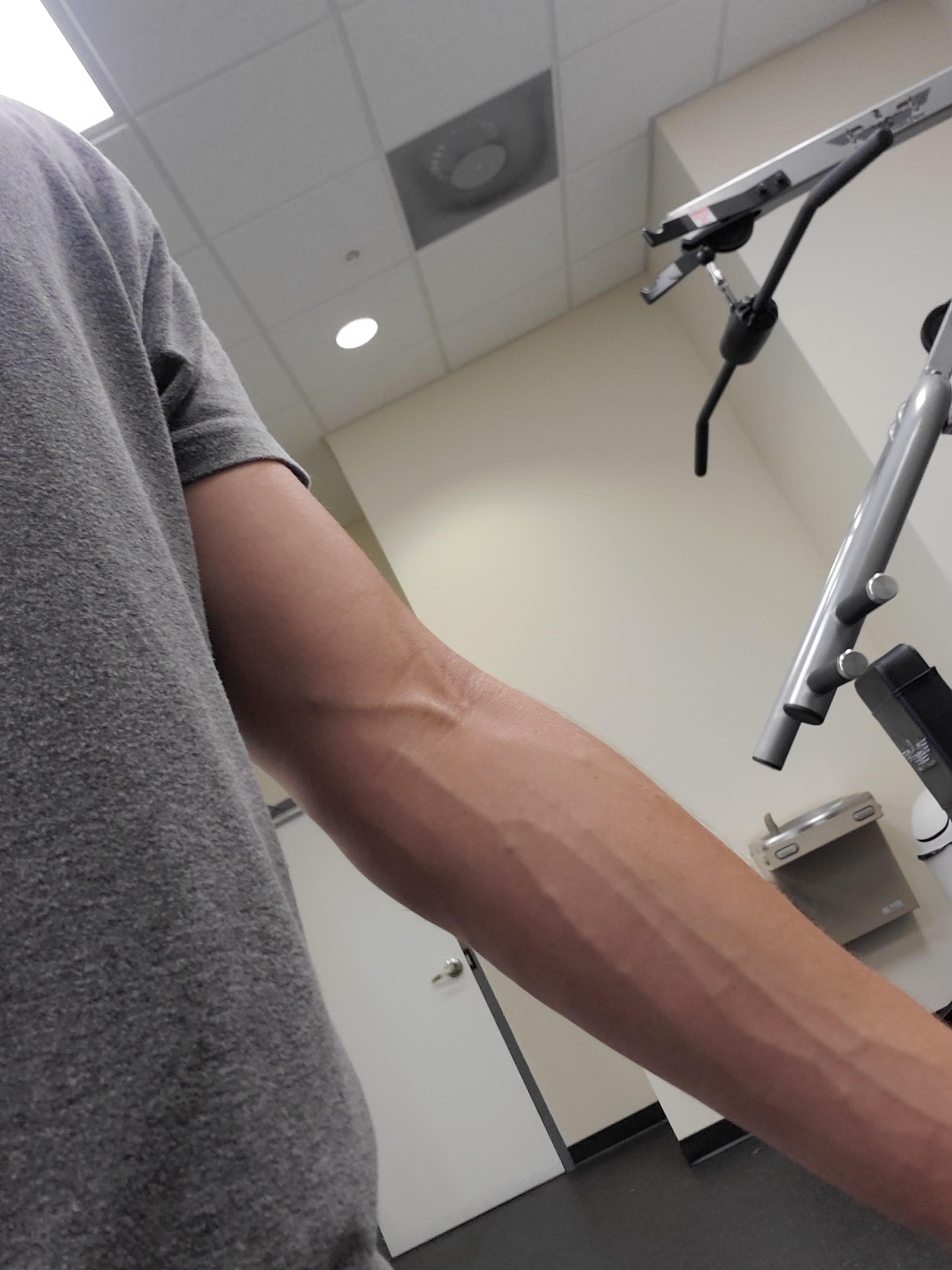 Does this qualify? | Scrolller