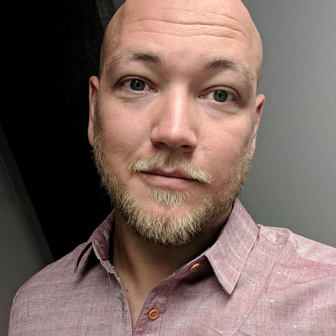 Embracing being bald! Thoughts? | Scrolller