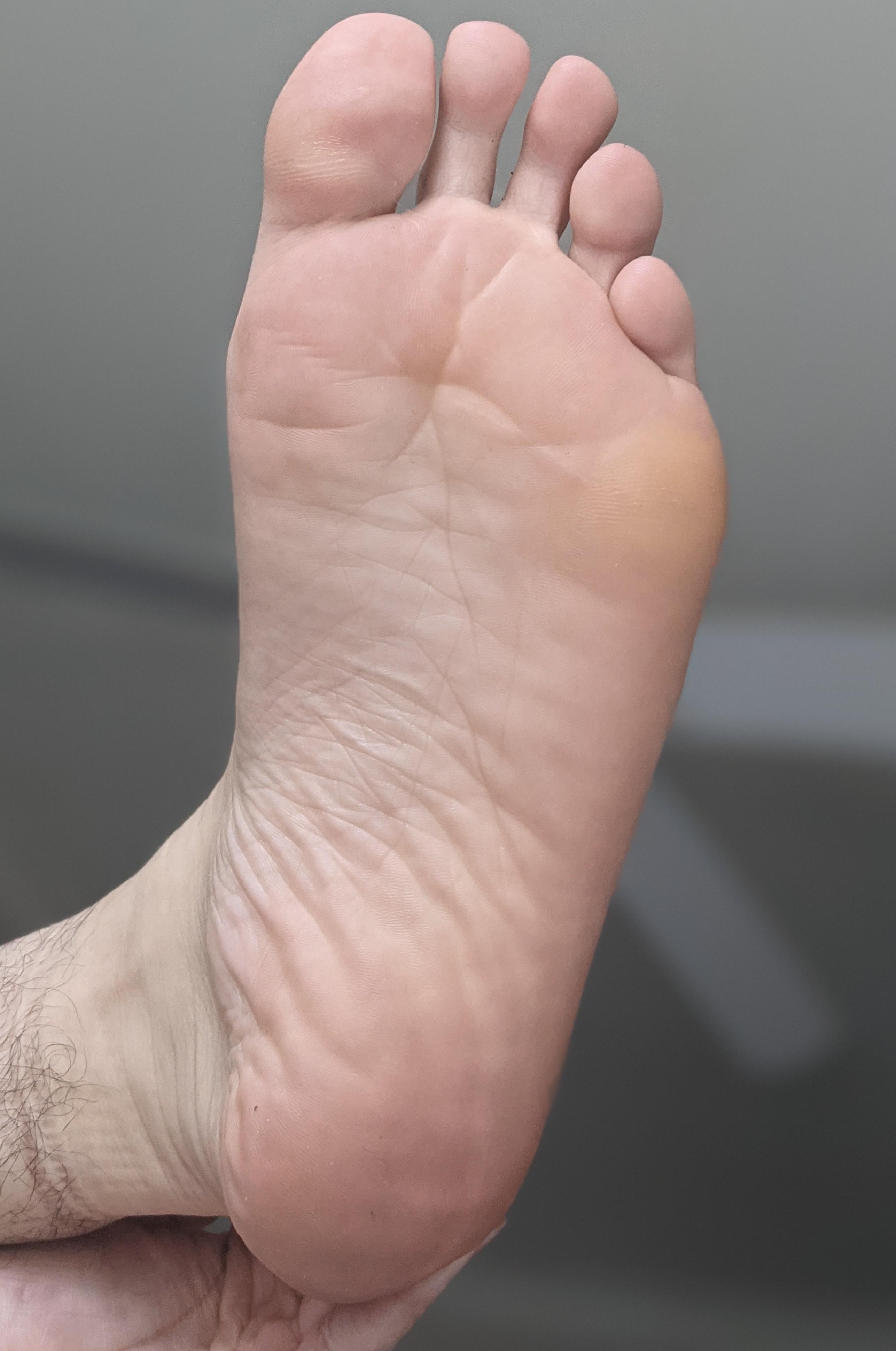 Sunny soles | Scrolller