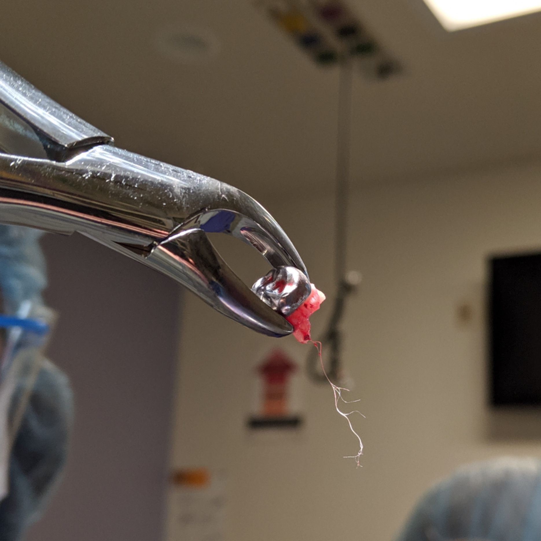 Extracted Tooth With Intact Nerve Root - Super Rare | Scrolller