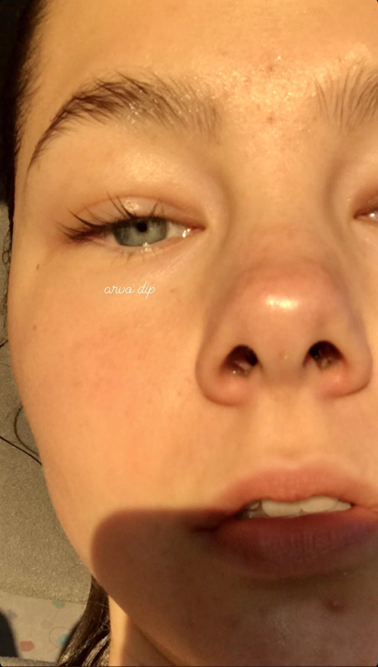 Eye, nostrils, lips and zit | Scrolller