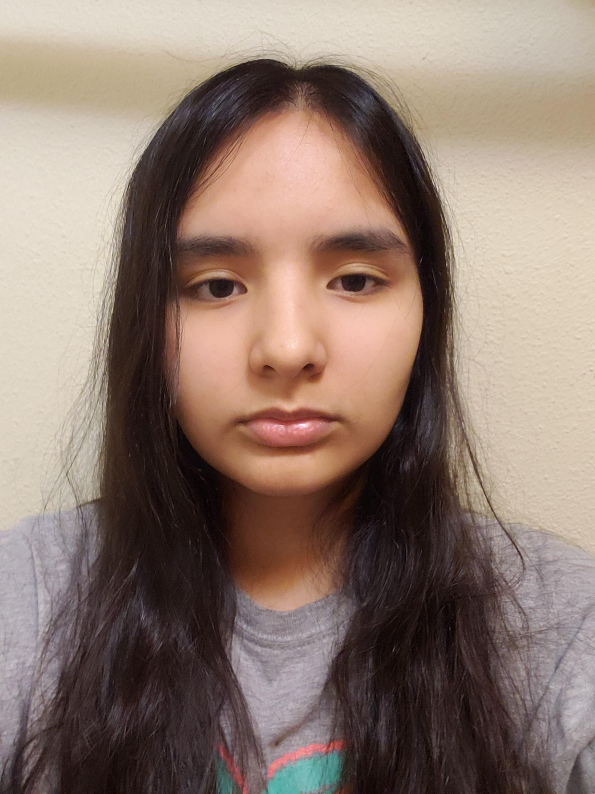 [F18] Do I have a big forehead? | Scrolller