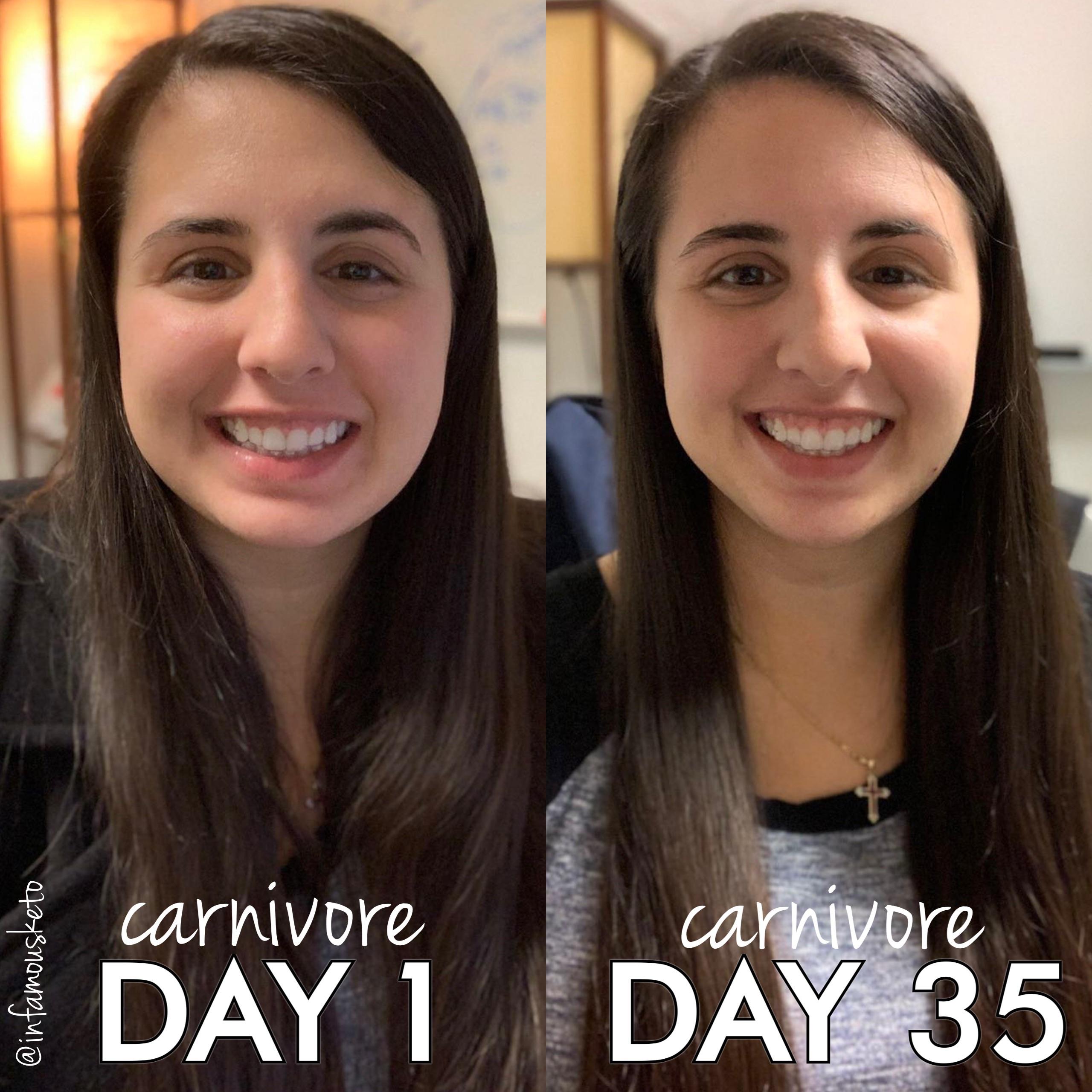 FACE GAINZ FRIDAY | Scrolller