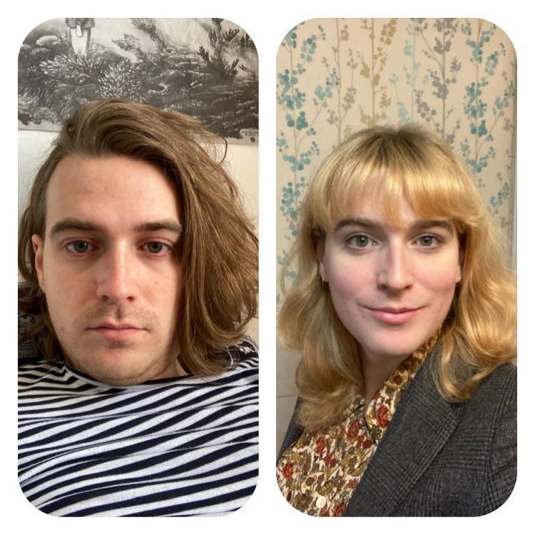 Felt like it was about time for another timeline pic... first day of HRT vs. 8.5 months!! 💕 ...