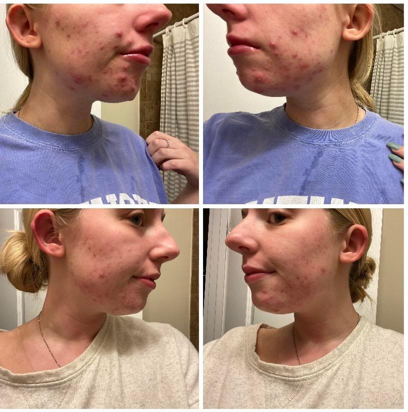 finally seeing progress!! (yes those are tears on my shirt in the top 2 ...