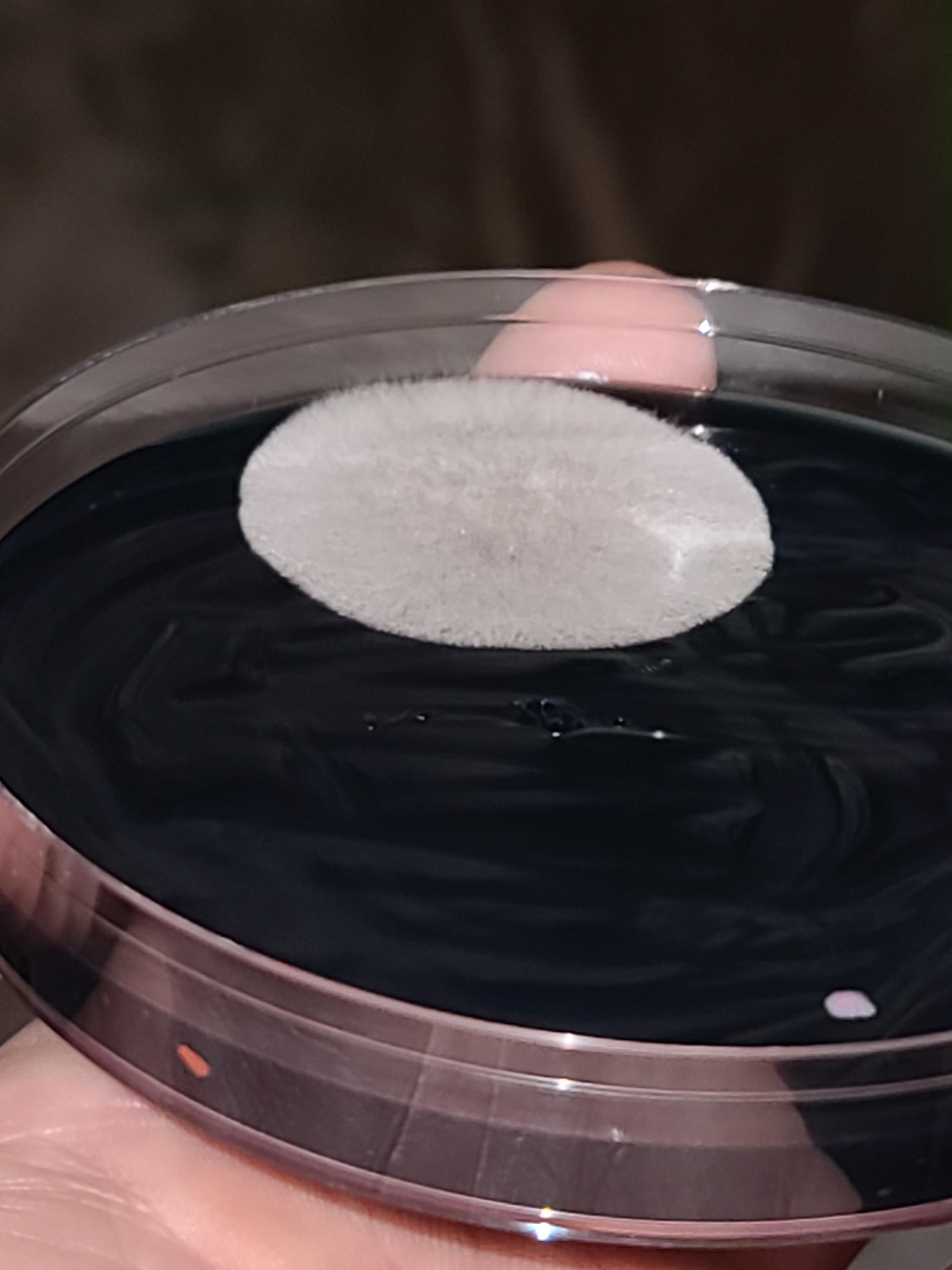 First time with agar...how's this spot of mycelium look | Scrolller