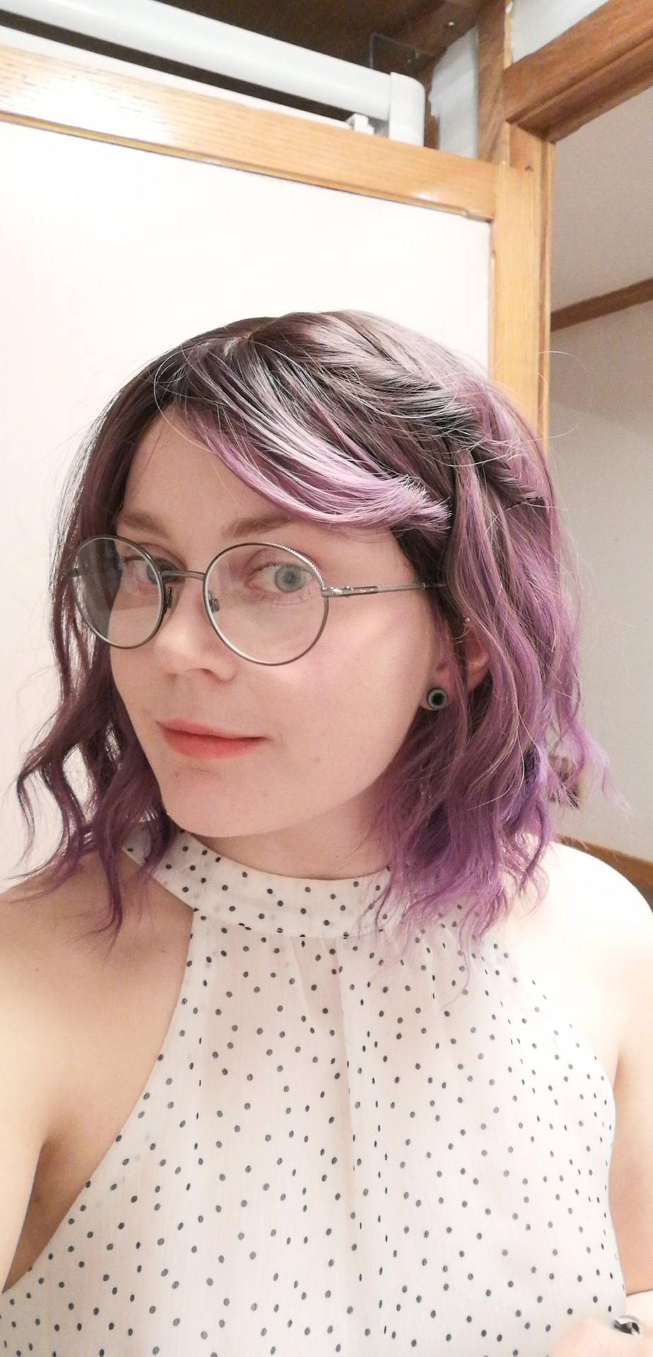 First wig to help cover hair loss from seborrheic dermatitis | Scrolller