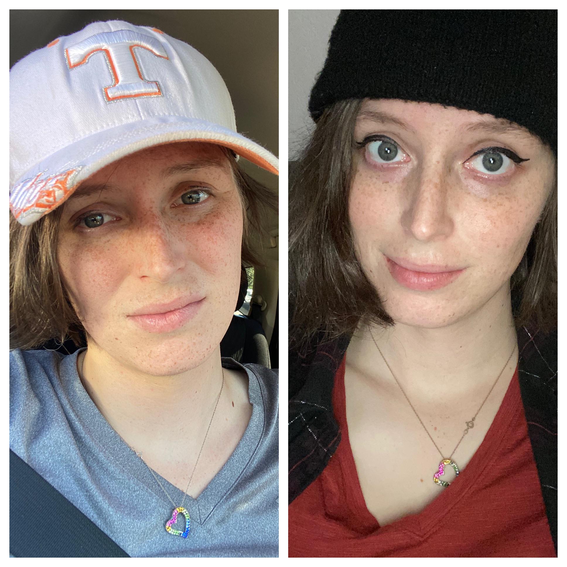 Four months difference after a regiment change. Some things are starting to line up 🥺 | Scrolller