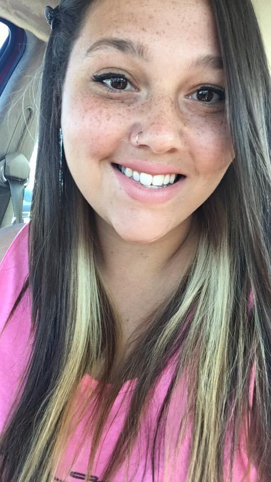 Freckles 😜 | Scrolller