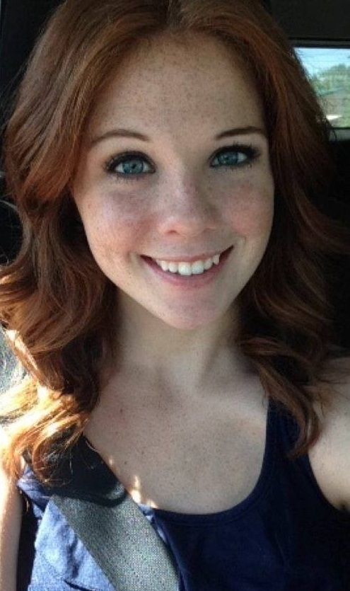 Freckles | Scrolller