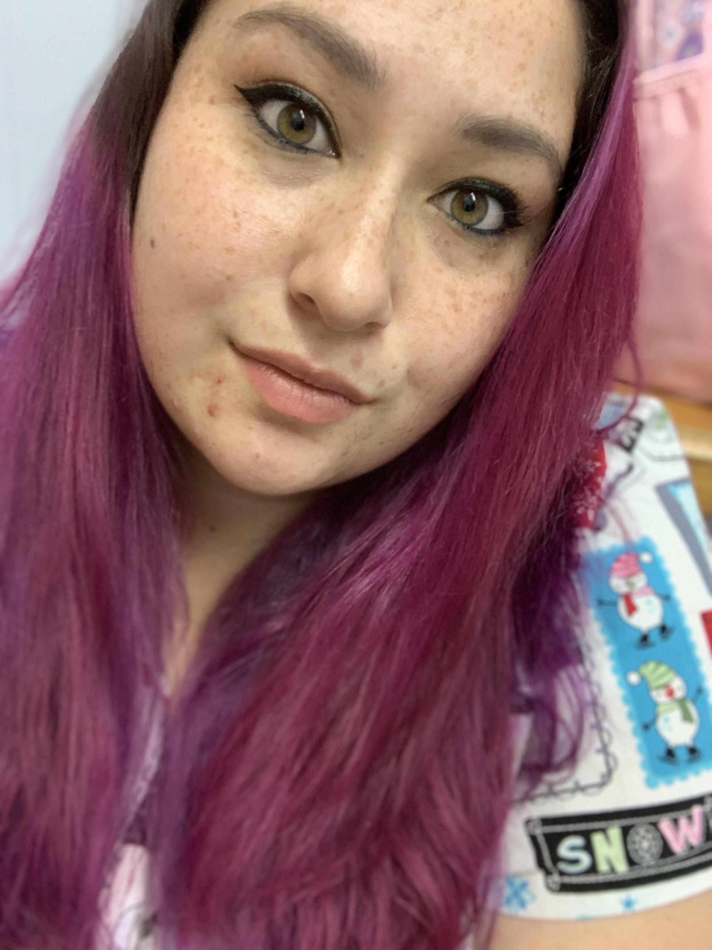 Freckles For Days 😊 Scrolller