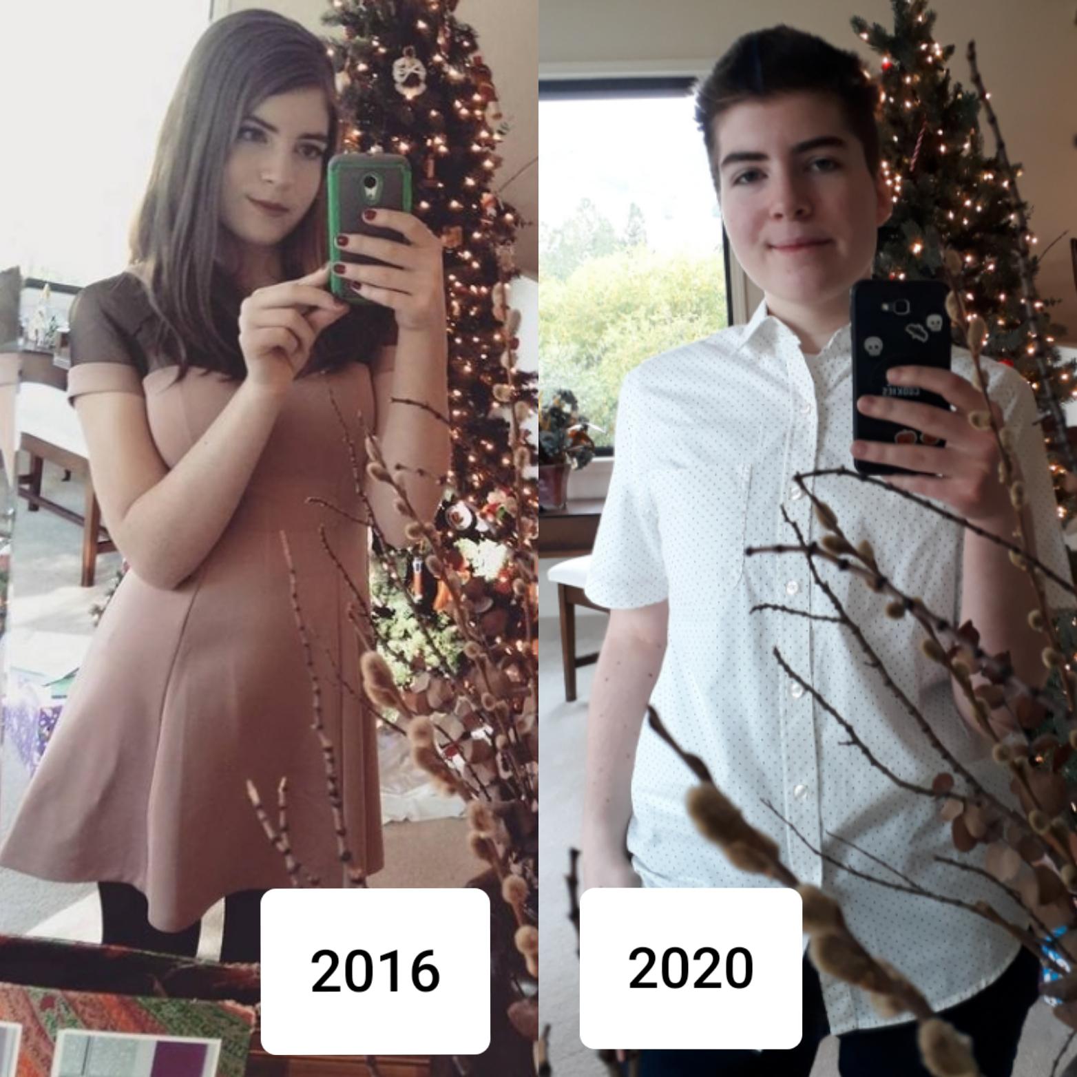 FtM, pre-everything but four years difference | Scrolller
