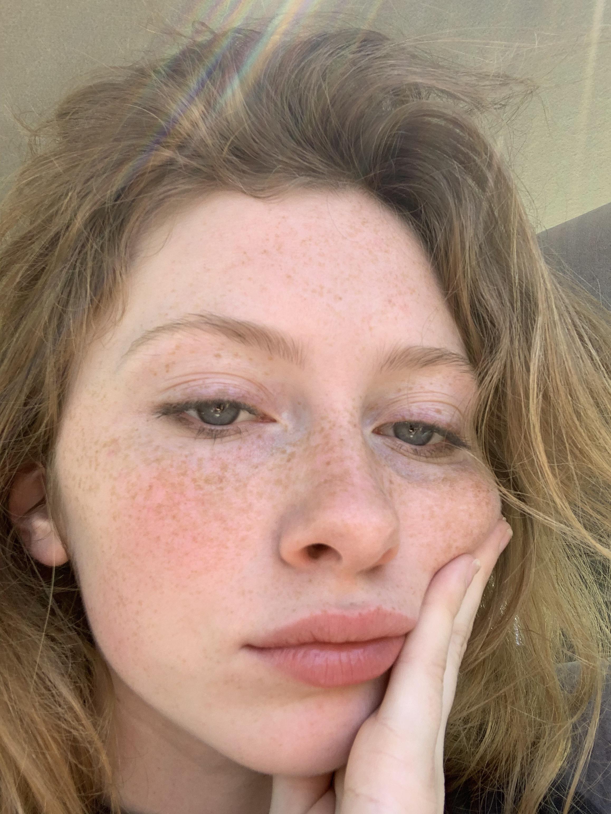 Hair Does What It Wants As Do My Freckles 🙃 Lol Scrolller