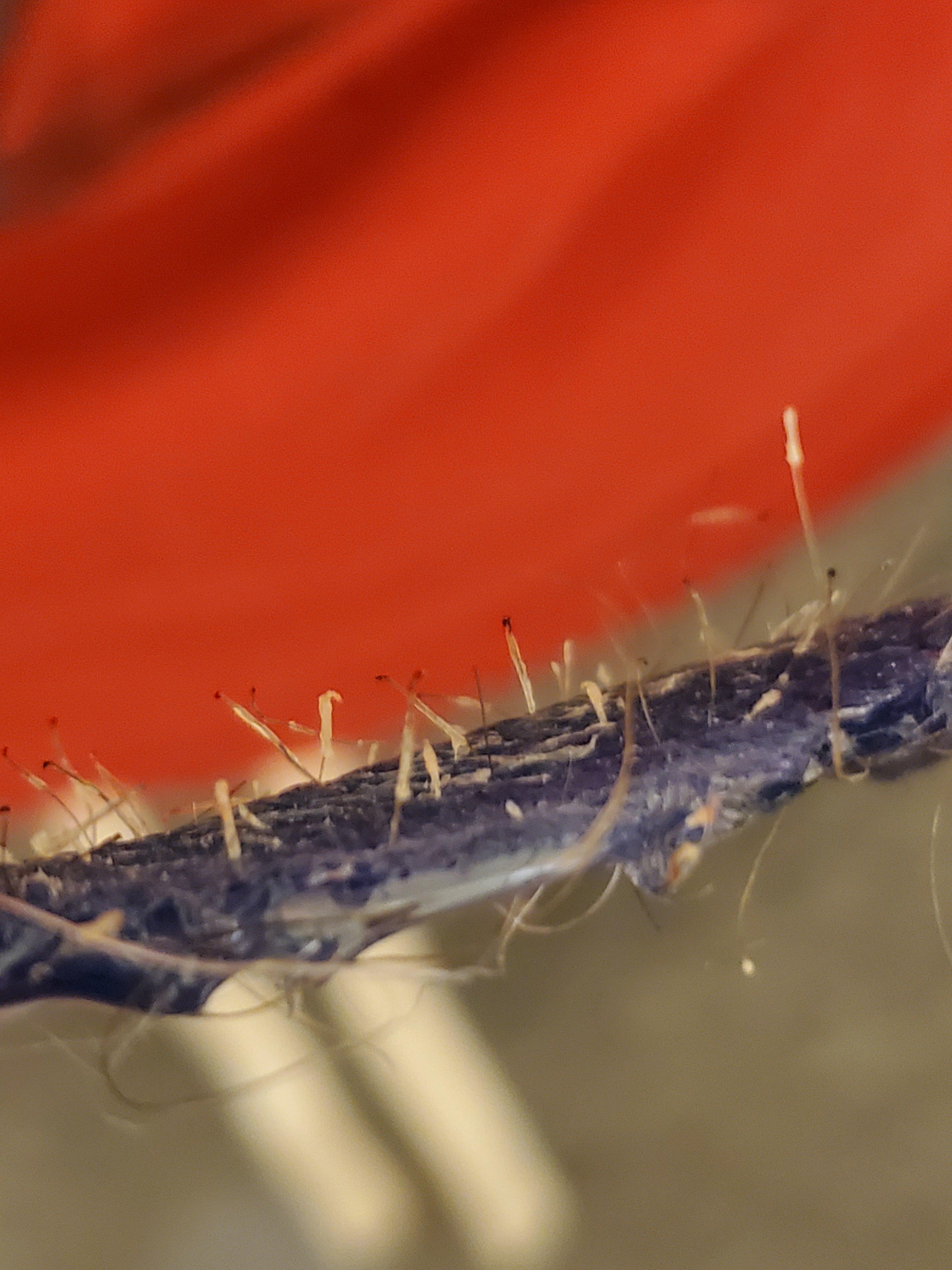 Hair follicles? | Scrolller