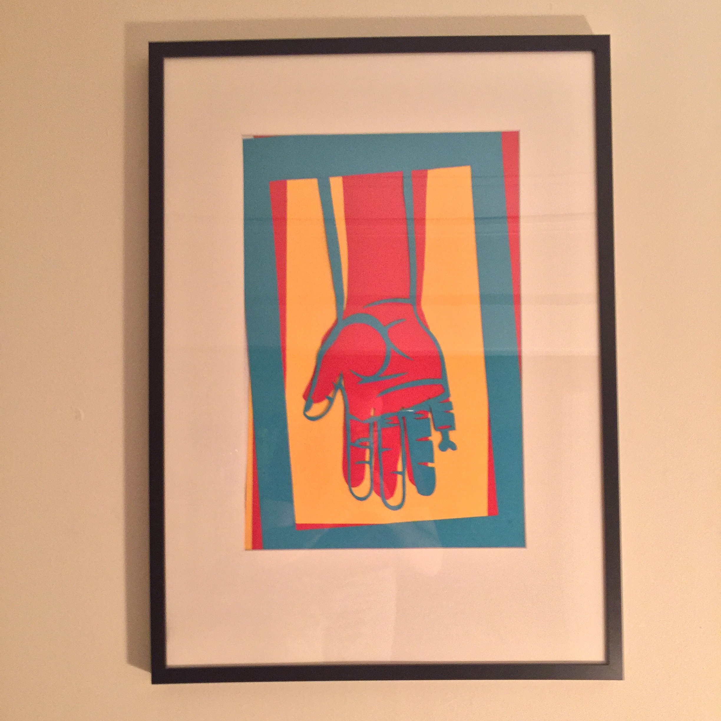 Hand with Exposed Bone- 2015 | Scrolller