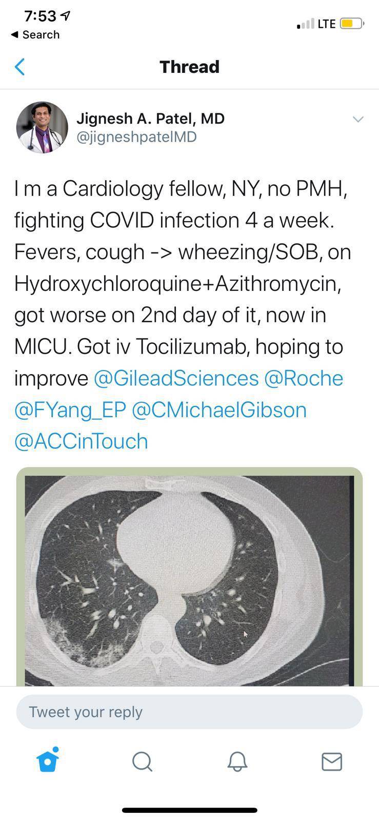 Healthy US Fellows now getting severe disease! | Scrolller