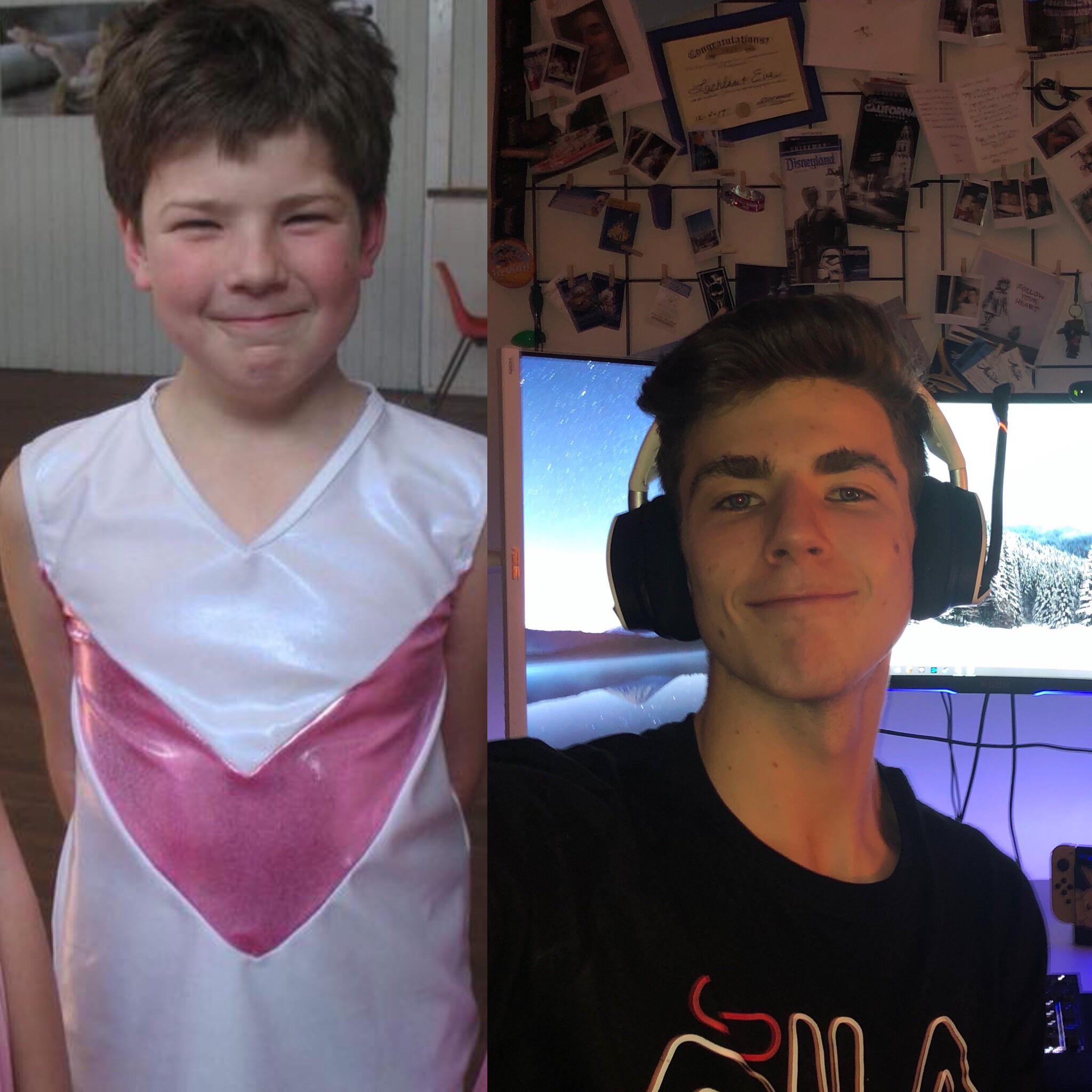 Here’s my 10 year difference! | Scrolller