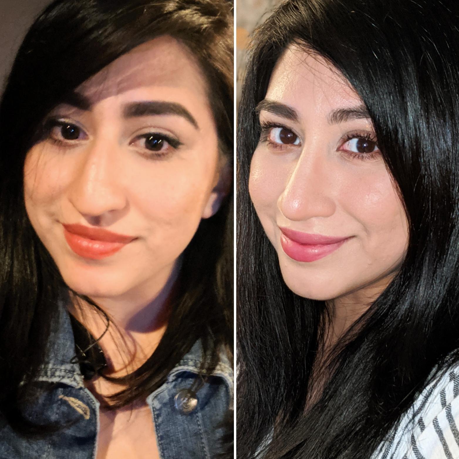 Here's another angle with similar makeup and angle. 5 months Post Op | Scrolller