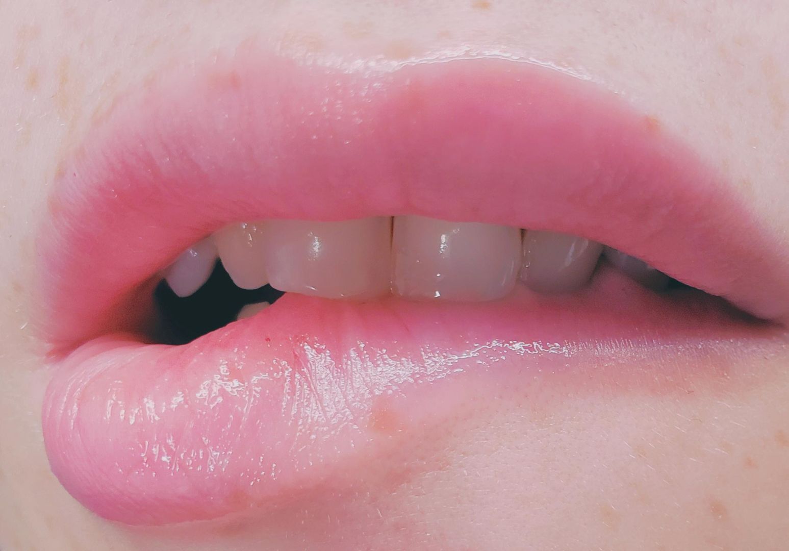 Hope You Like My Face Battler First Time Taking Lip Pictures