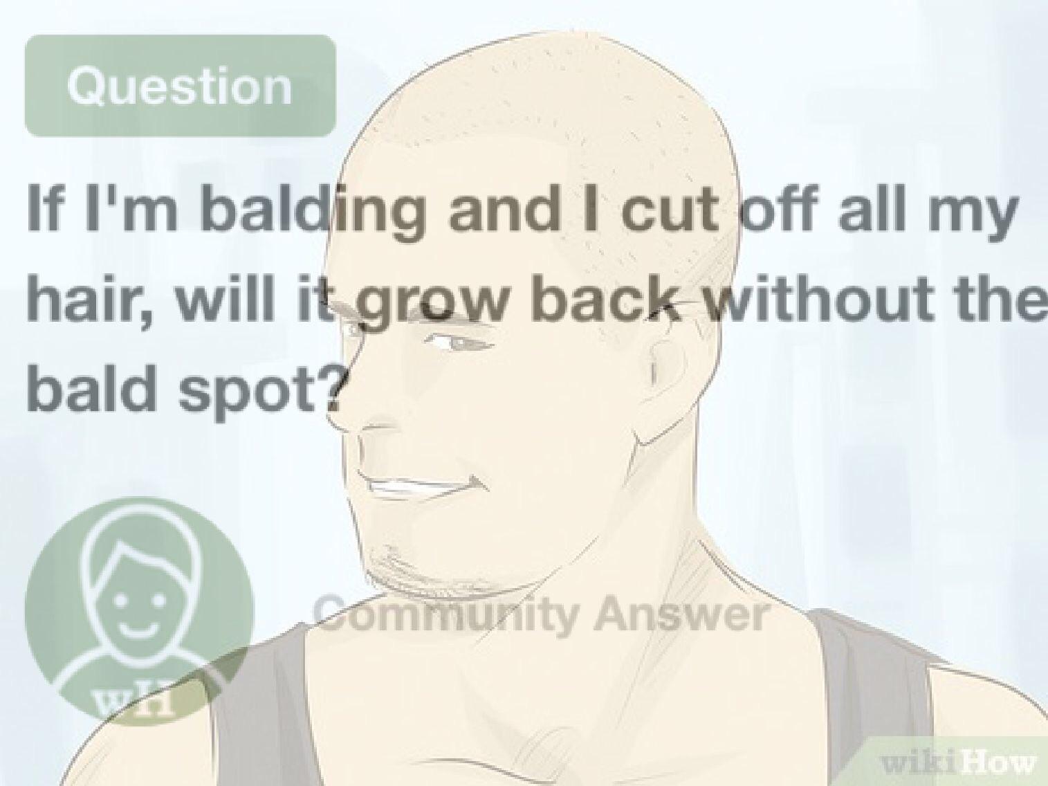 How to Tell if You're Going Bald. | Scrolller