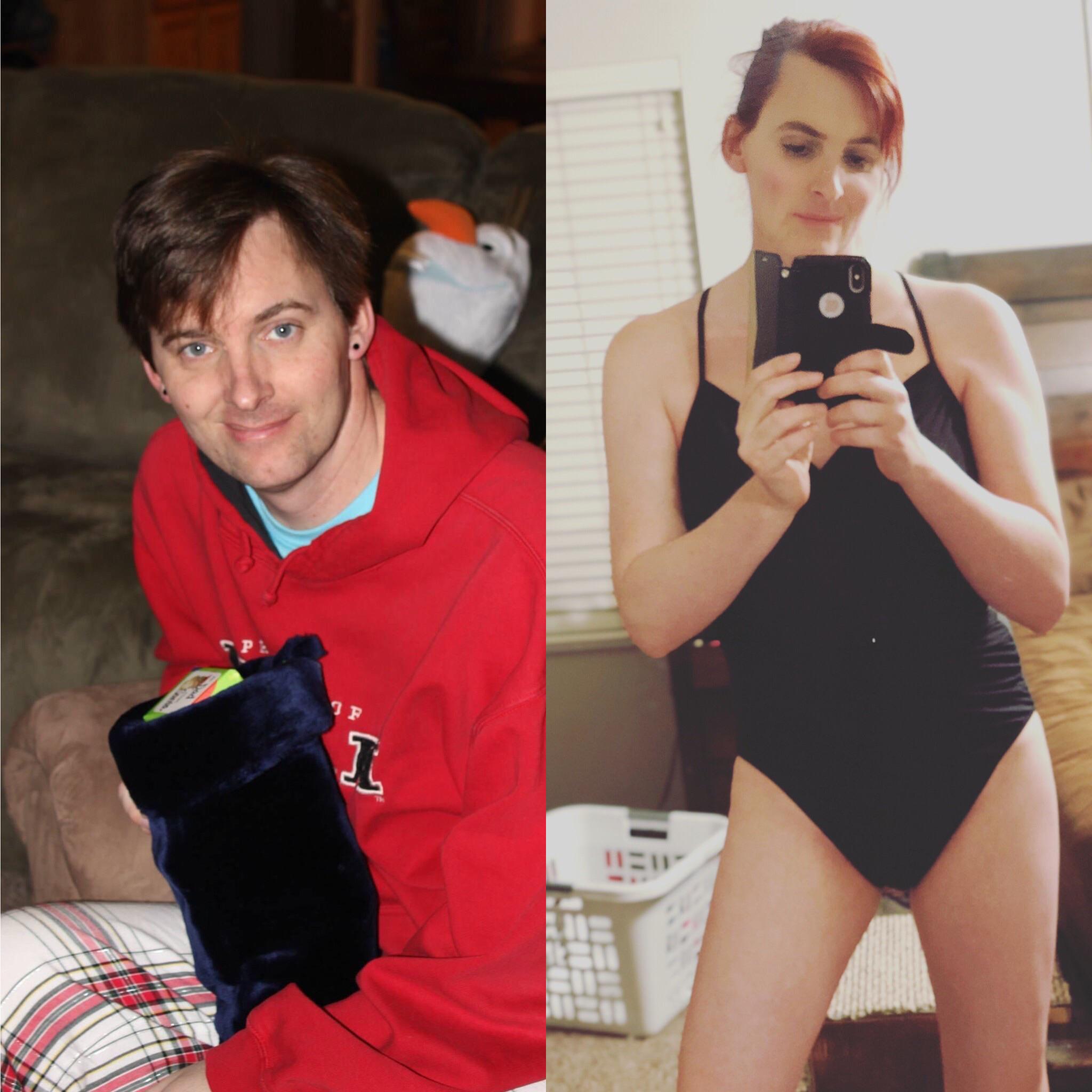 HRT is a lifesaver! 3 months hrt —> 6 years hrt | Scrolller