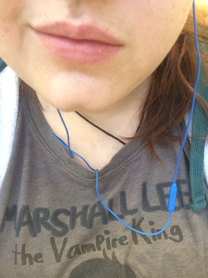 I have freckles everywhere, oops | Scrolller