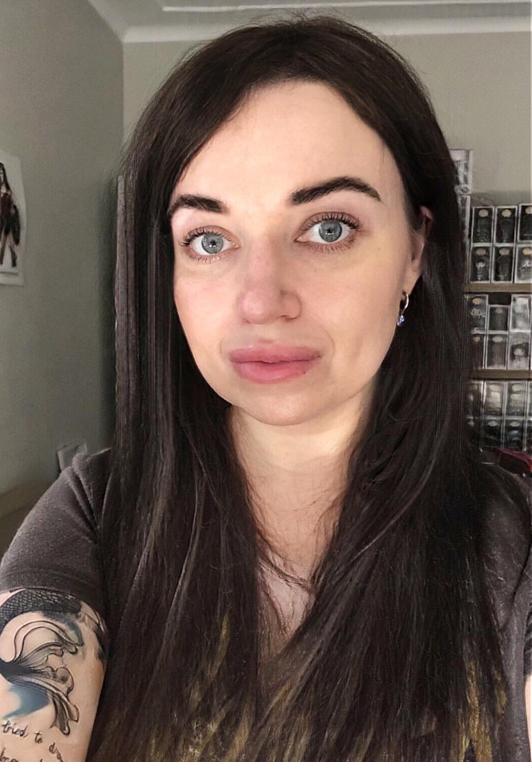 I’m most self conscious of my dark under circles haven’t sleep well due to ptsd😞 | Scrolller