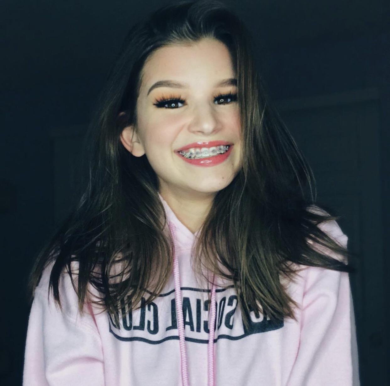 I miss the braces :( | Scrolller