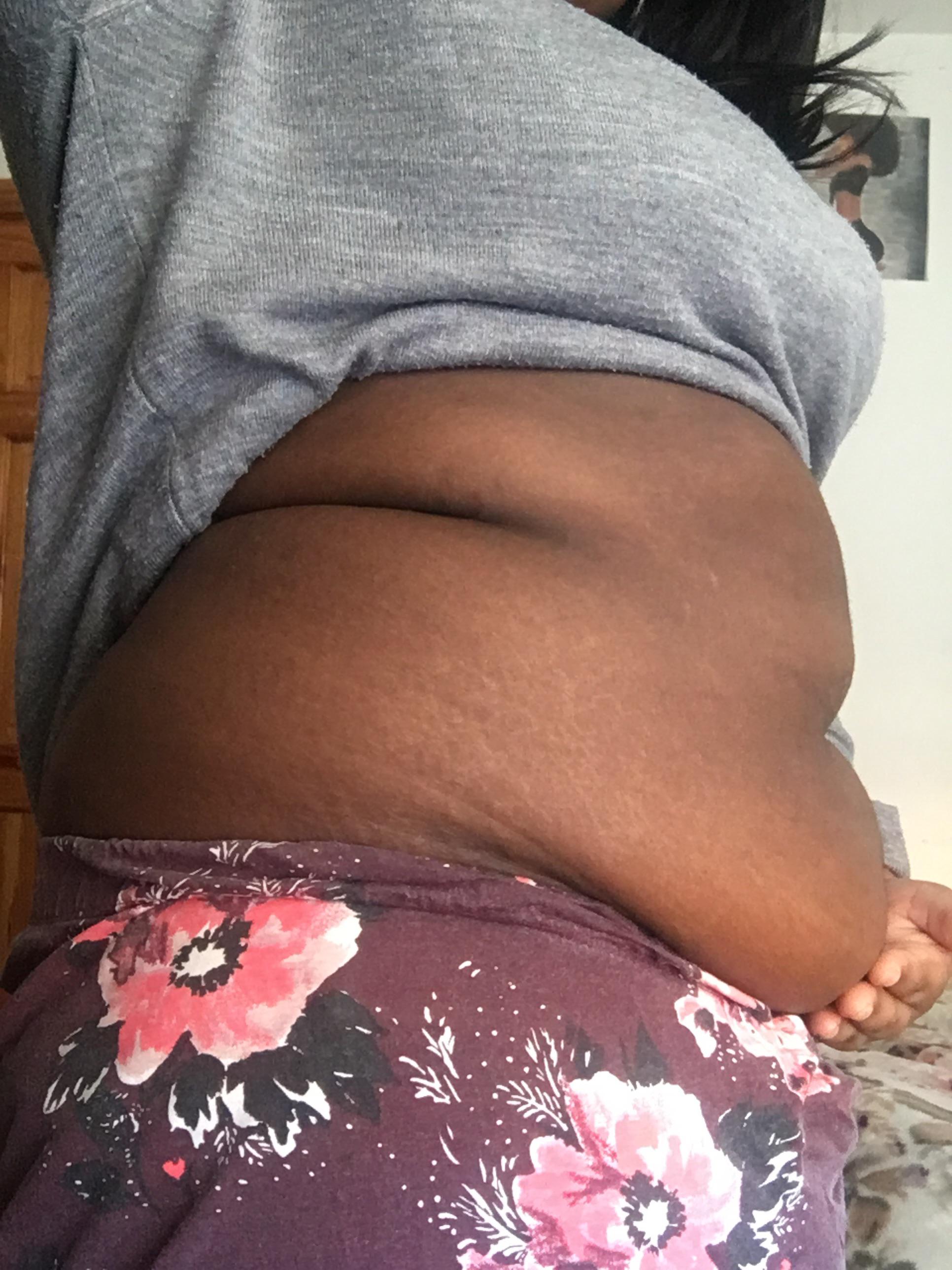 In need of a belly rub 🥰😘 | Scrolller