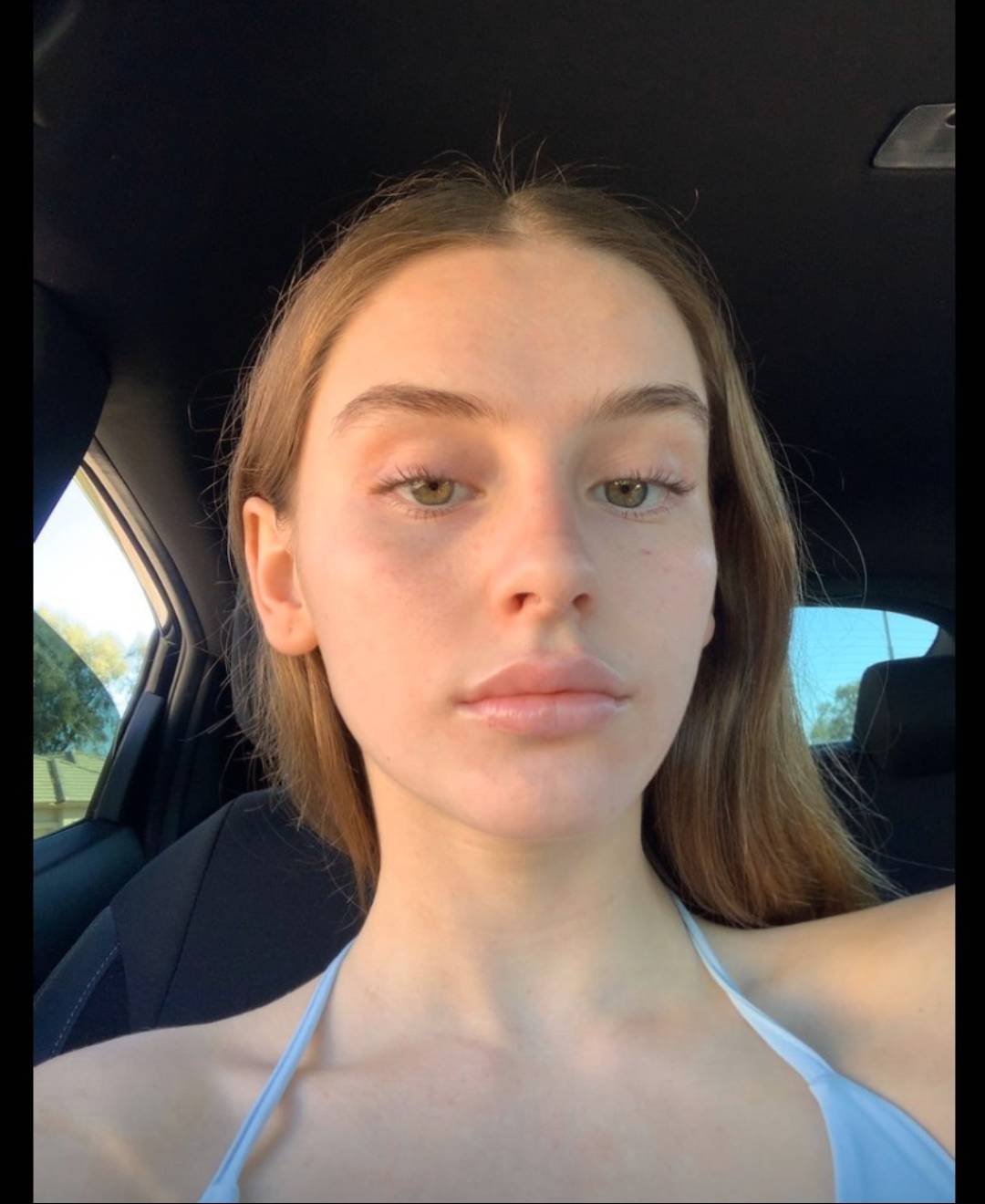 insta story | Scrolller