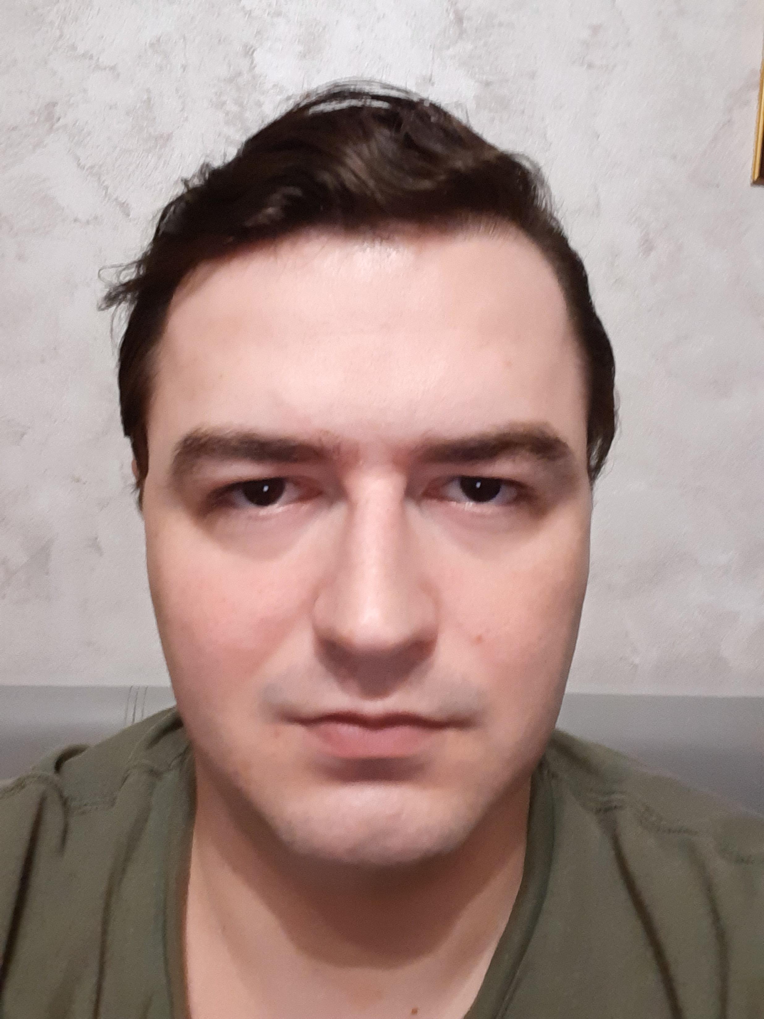 Is my forehead too large? | Scrolller