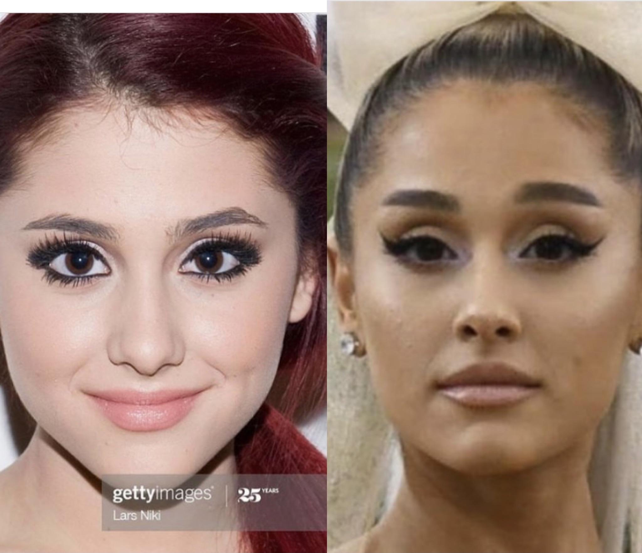 Is this a botched brow lift? | Scrolller