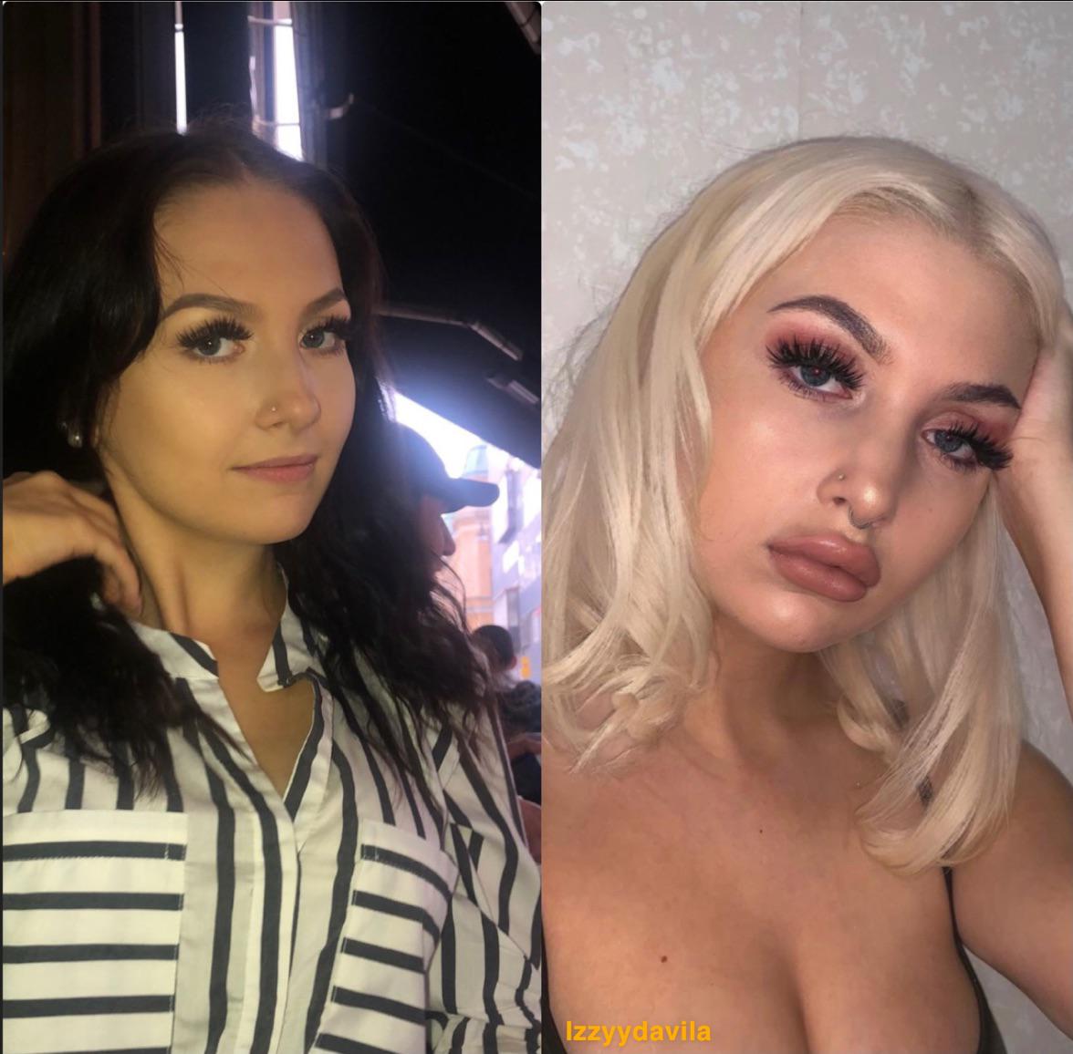 Izzy here once again! Here is another drastic side by side transformation 😚😚 | Scrolller