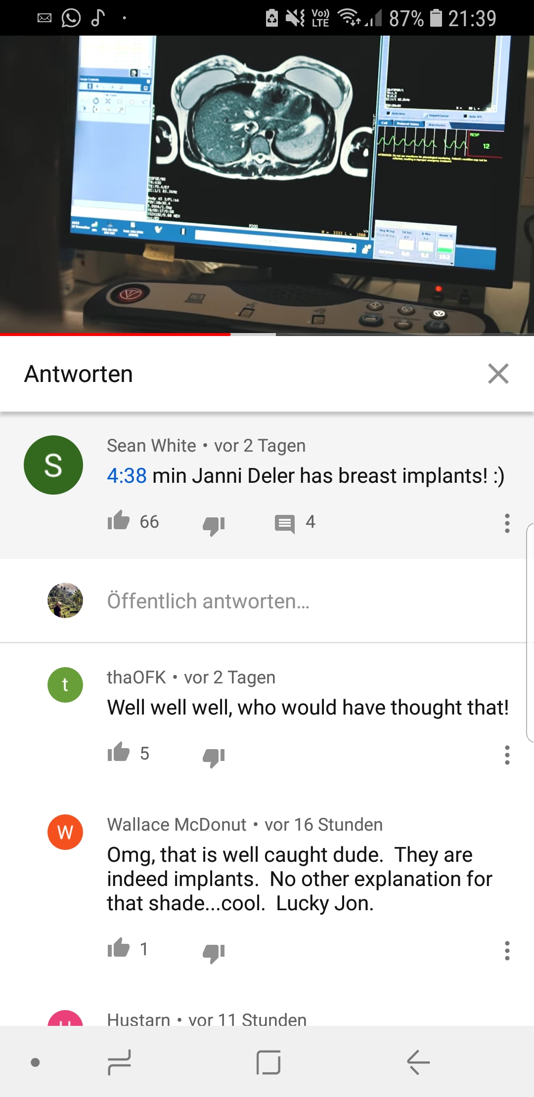 Janni has fake Boobs sry guys | Scrolller