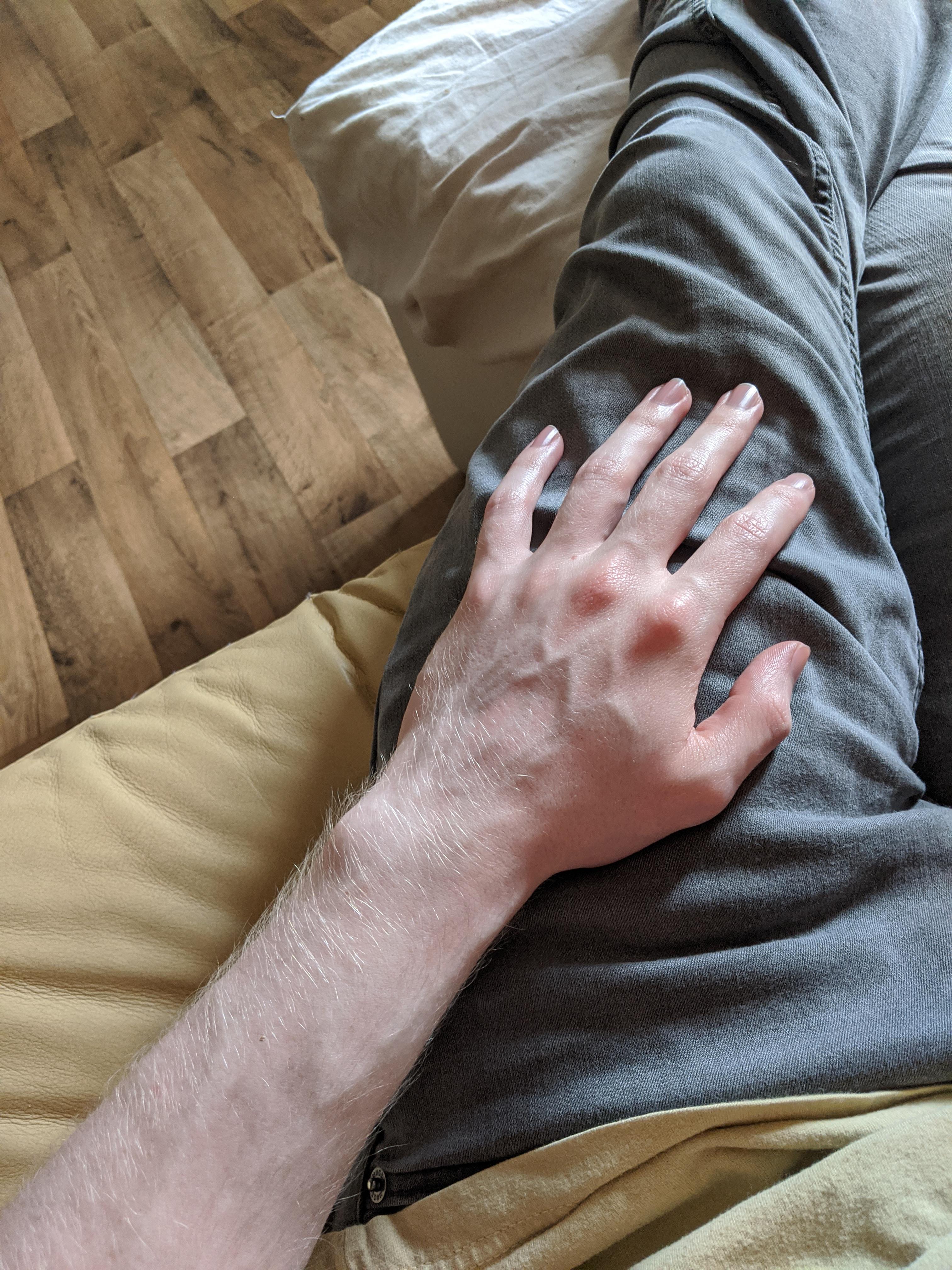 Just posting hand | Scrolller