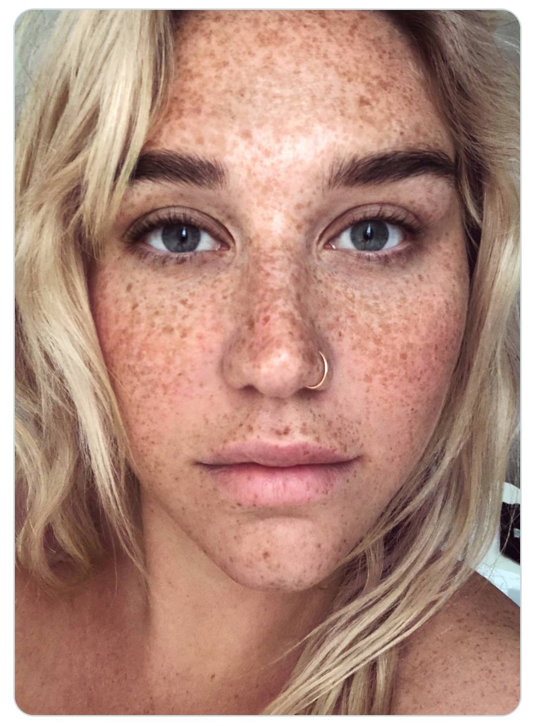Kesha's freckles | Scrolller