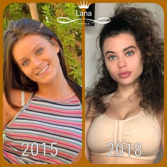 Lana rhodes | Scrolller