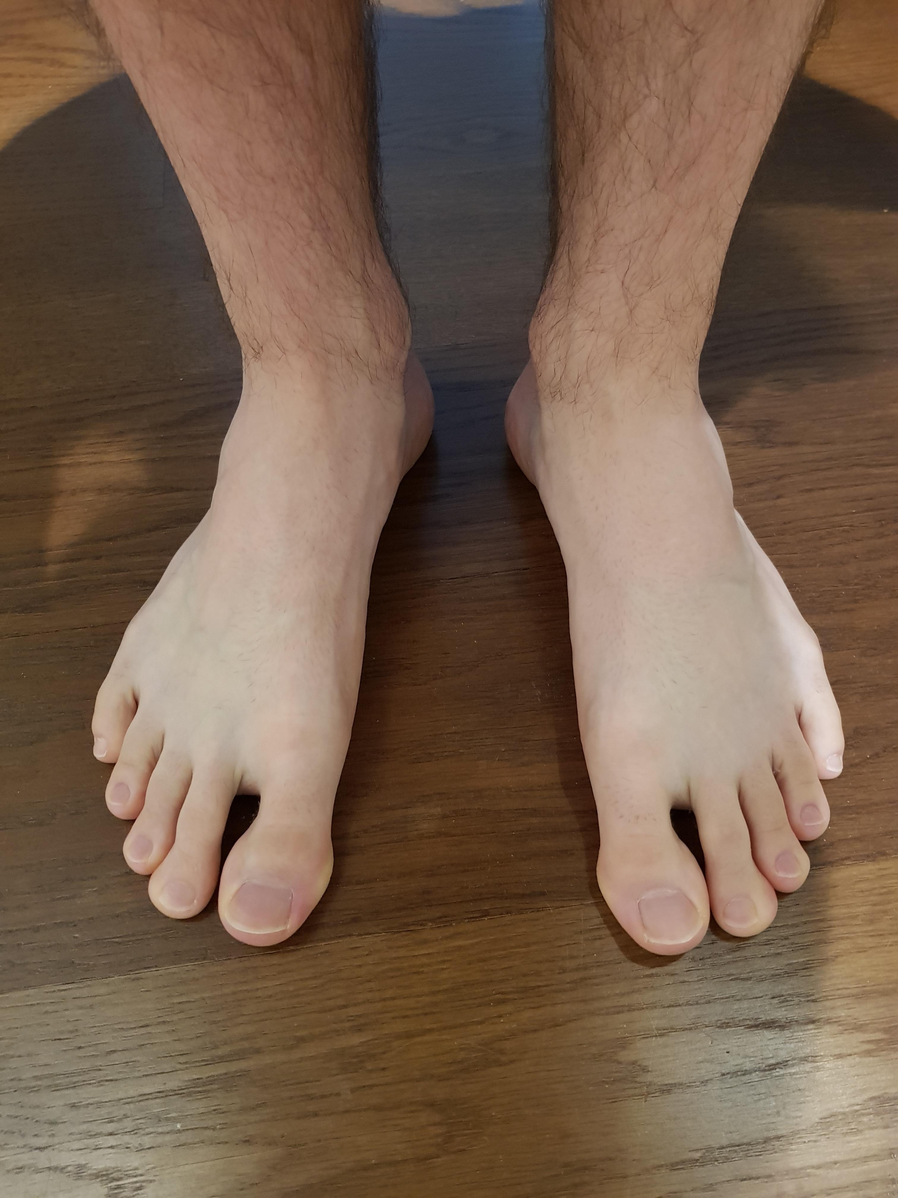 light and shadows :p | Scrolller