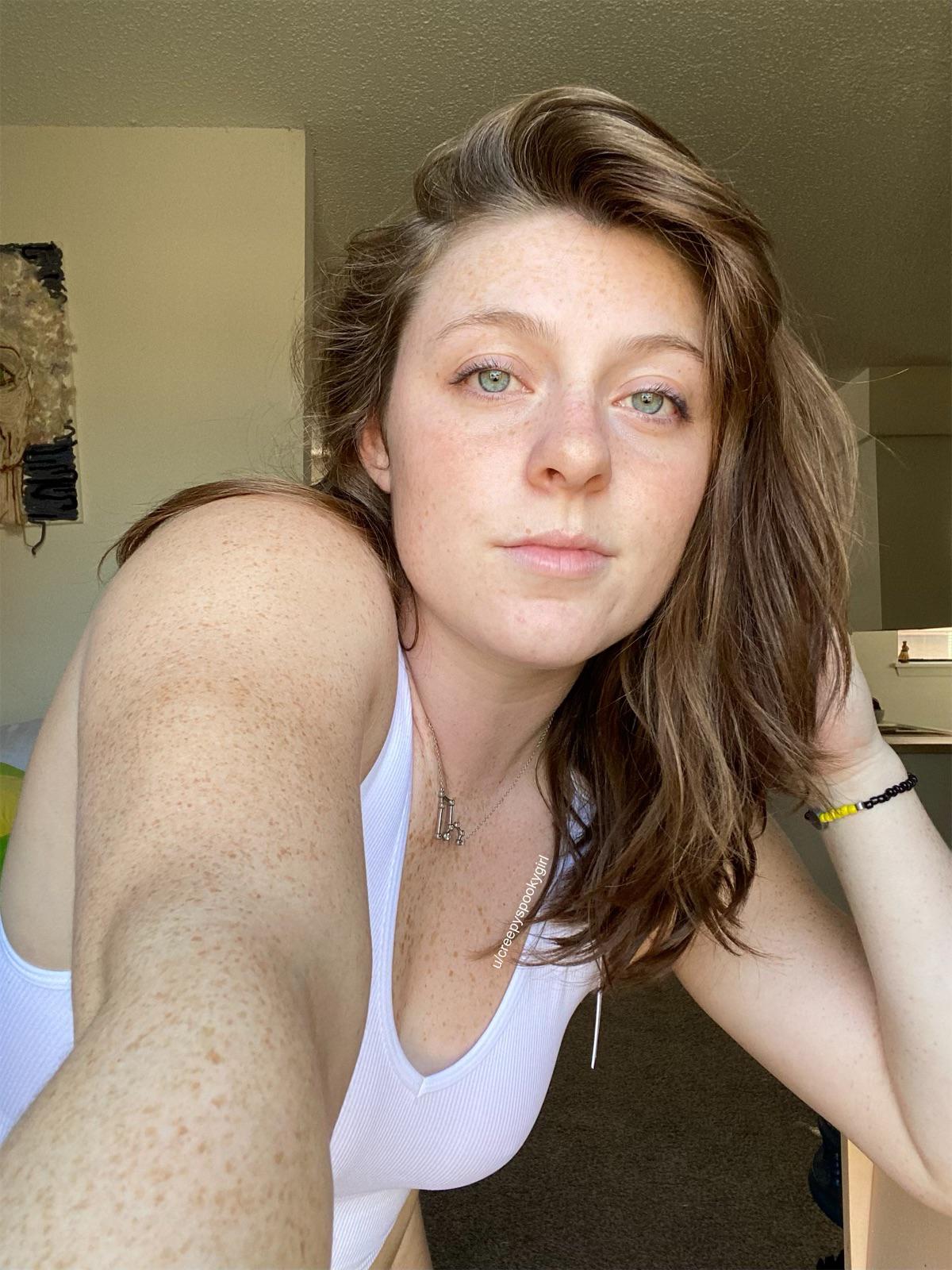 Freckles face | Scrolller